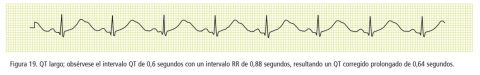 Realización e interpretación básica de un electrocardiograma - Soy Medicina