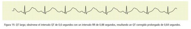 Realización e interpretación básica de un electrocardiograma - Soy Medicina