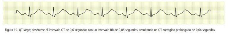 Realización e interpretación básica de un electrocardiograma - Soy Medicina