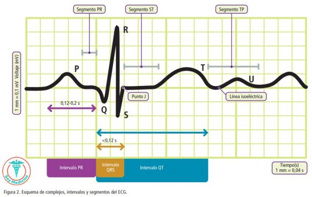 Realización e interpretación básica de un electrocardiograma - Soy Medicina