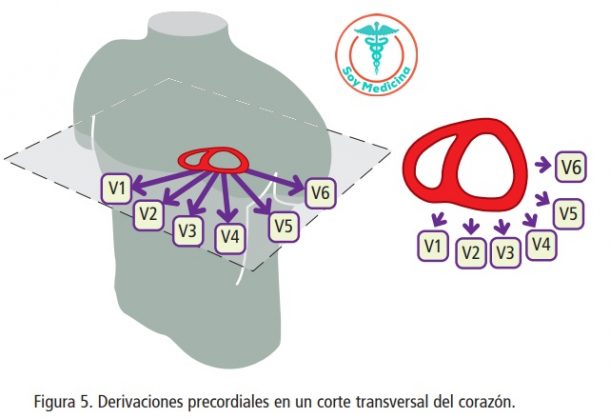 Realización e interpretación básica de un electrocardiograma - Soy Medicina